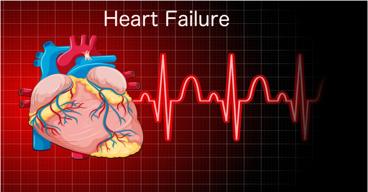 Understanding Heart Failure: Causes, Symptoms, and Treatment - Your ...