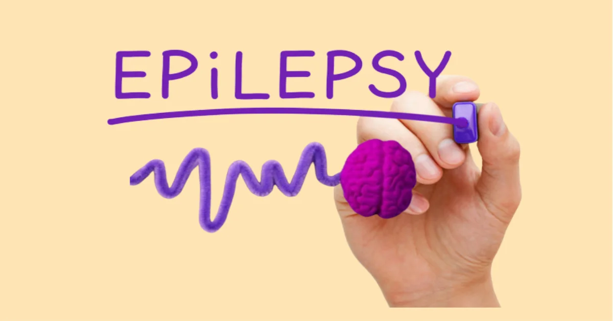 Understanding Epilepsy: From Diagnosis to Management - Your Ultimate ...