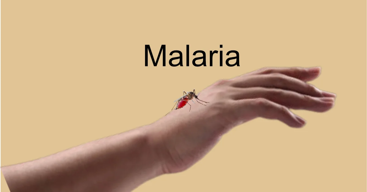 Understanding Malaria: Causes, Symptoms and Management - Your Ultimate ...